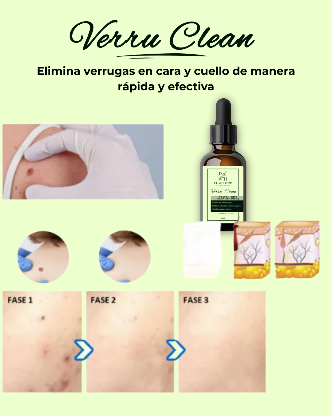 VERRU CLEAN - ¡OFERTA 2X1! Serum + Crema - Pure Herb
